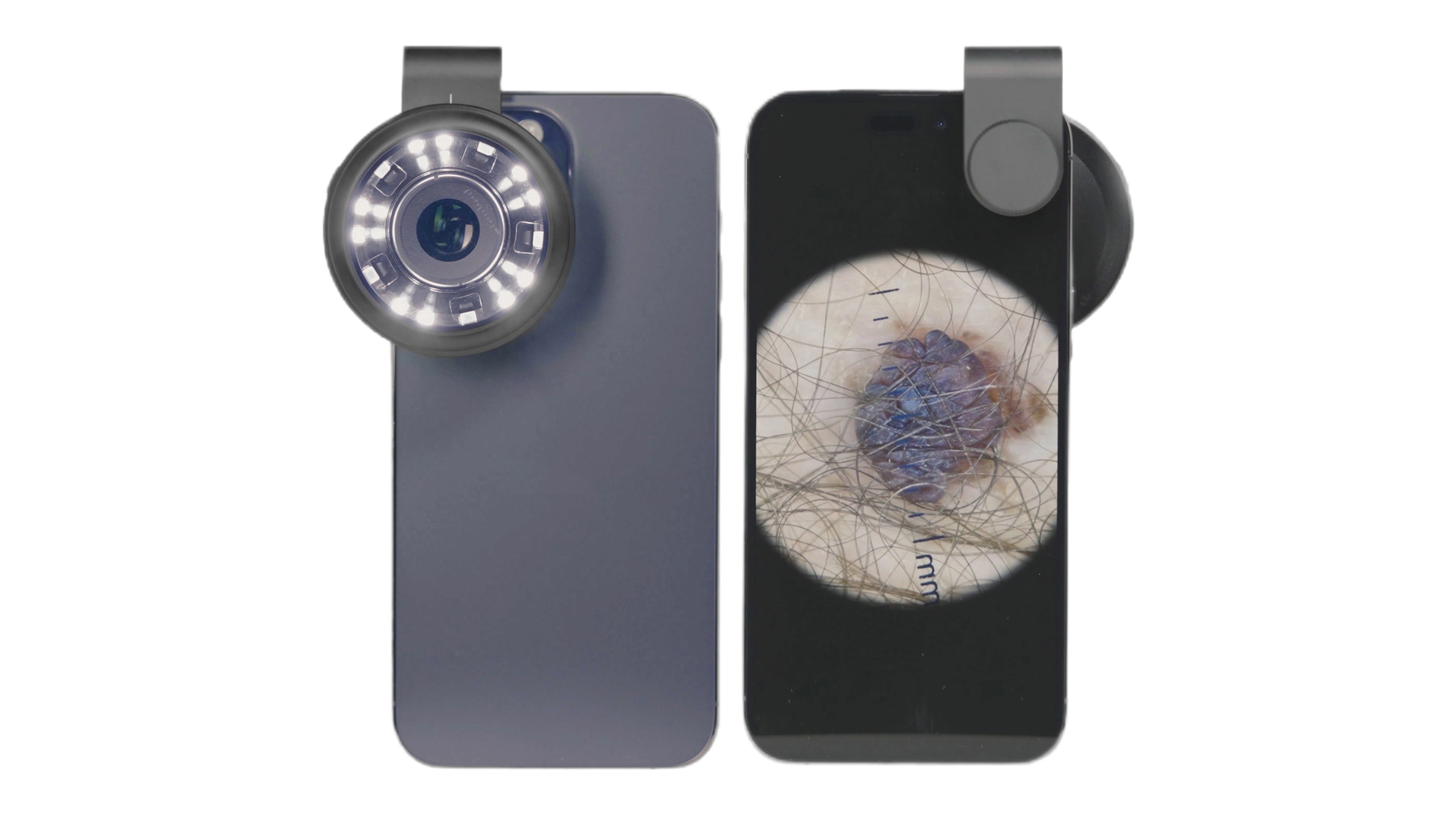 IBOOLO Wood’s Lamp – IBOOLO